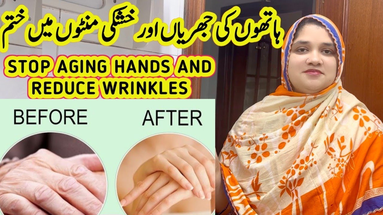 How to Stop AGING HANDS, Reduce Wrinkles, Dry, Thinning skin/ Hand ...