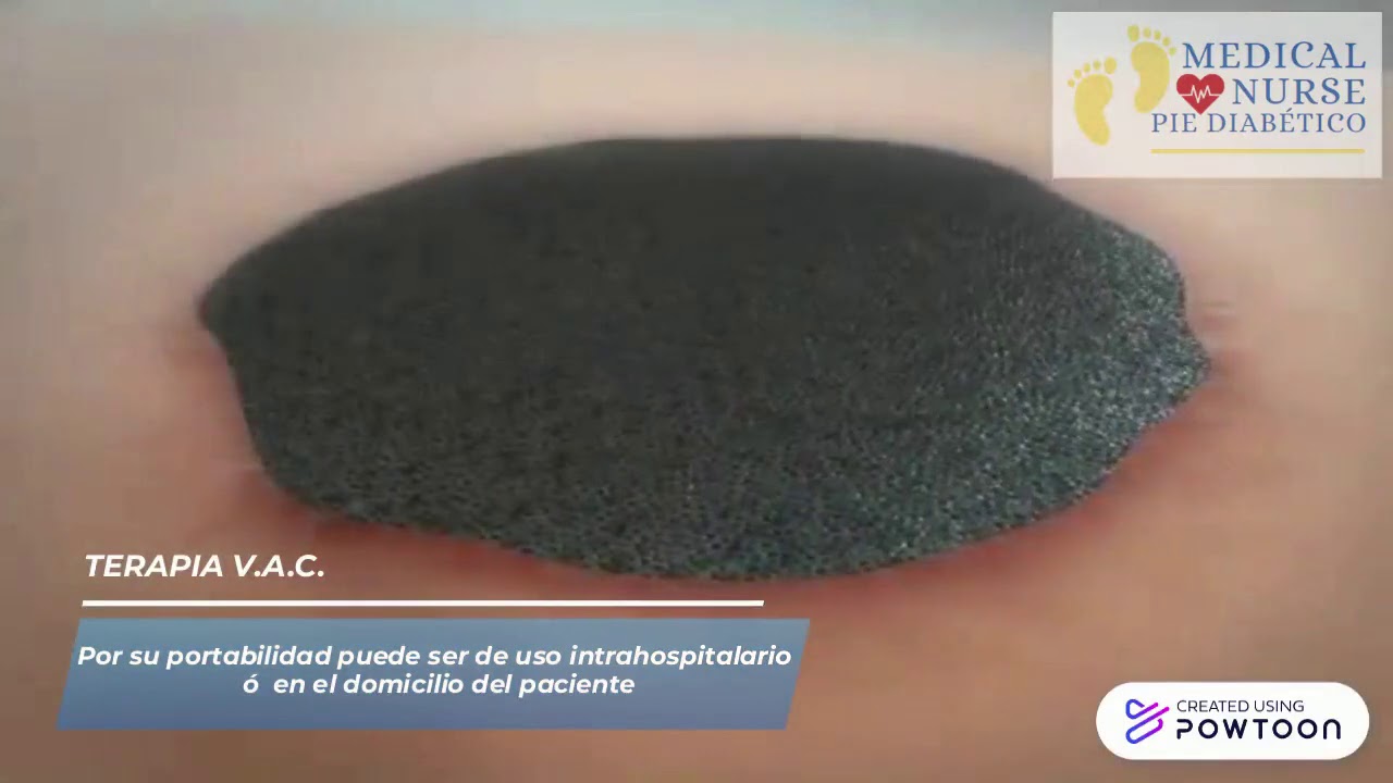 TERAPIA VAC / Manejo Avanzado de Heridas - YouTube