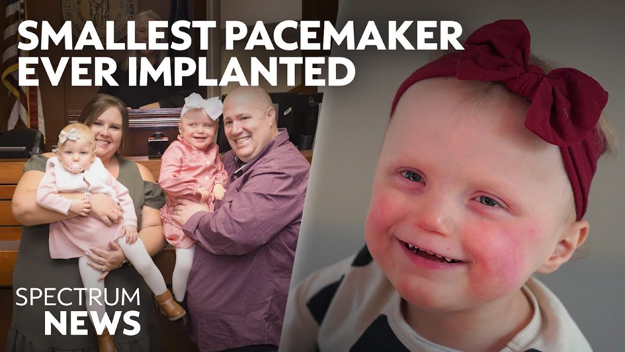 How this newborn's life was saved by miniature pacemaker | Spectrum ...