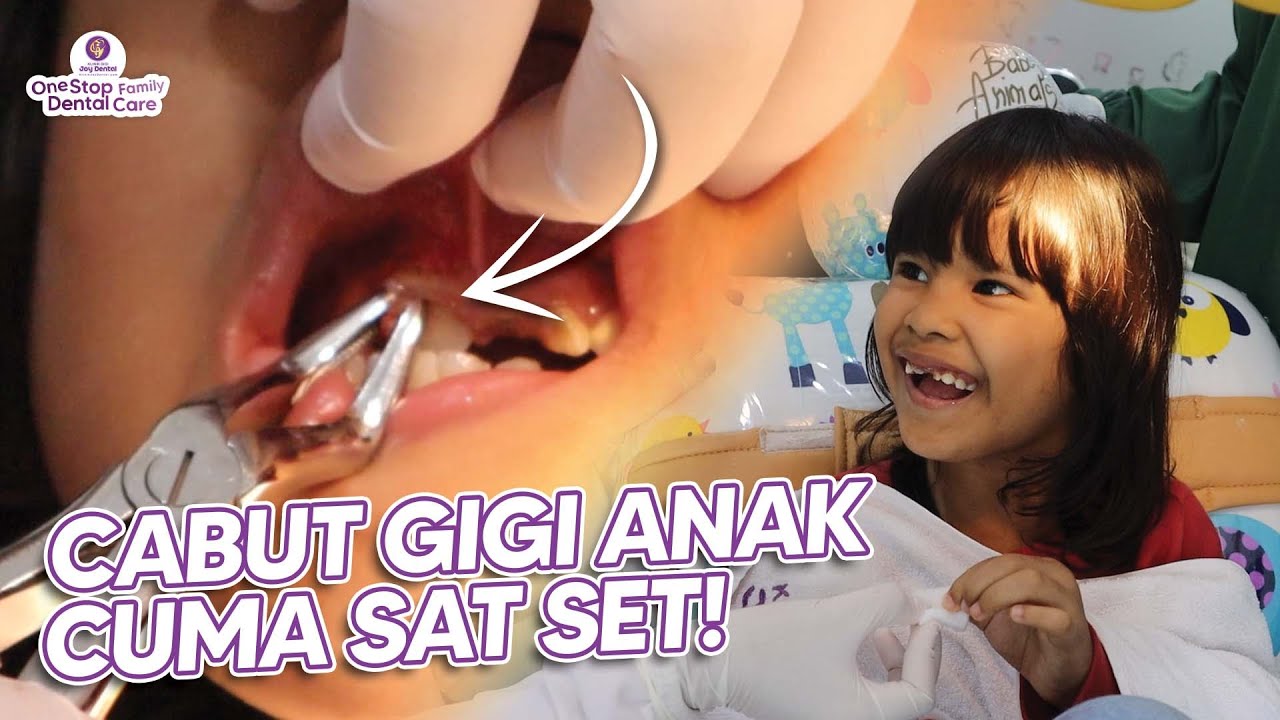 CABUT GIGI ANAK GA PAKE SAKIT DI DOKTER GIGI - YouTube