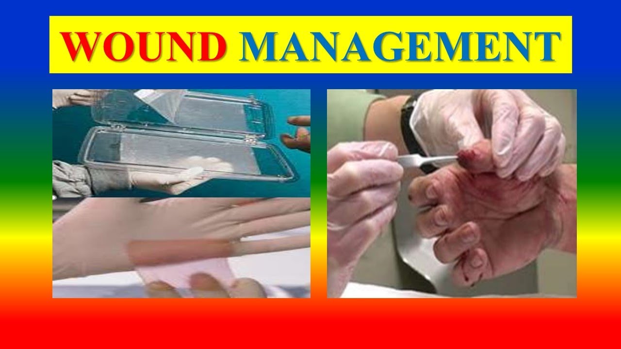 WOUND MANAGEMENT - YouTube