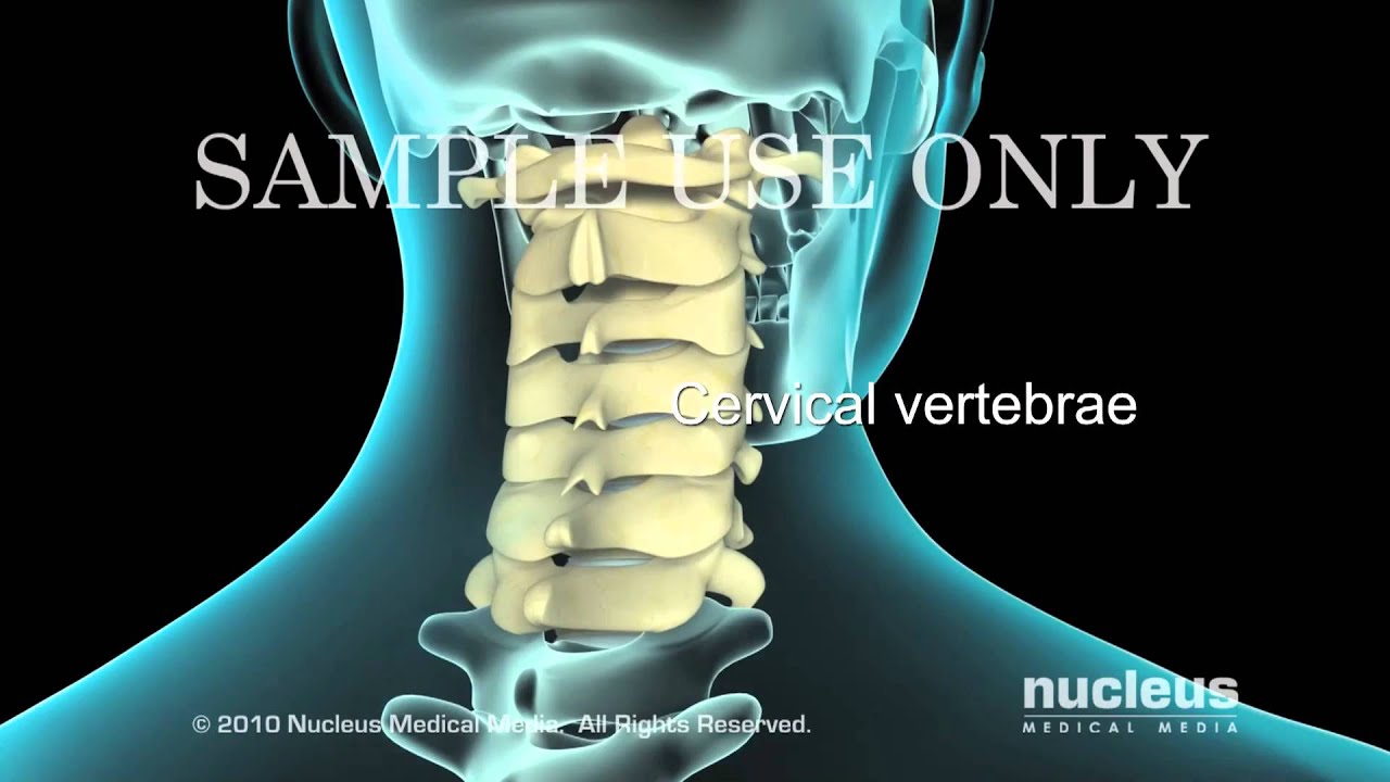 Lumbar Laminectomy - YouTube
