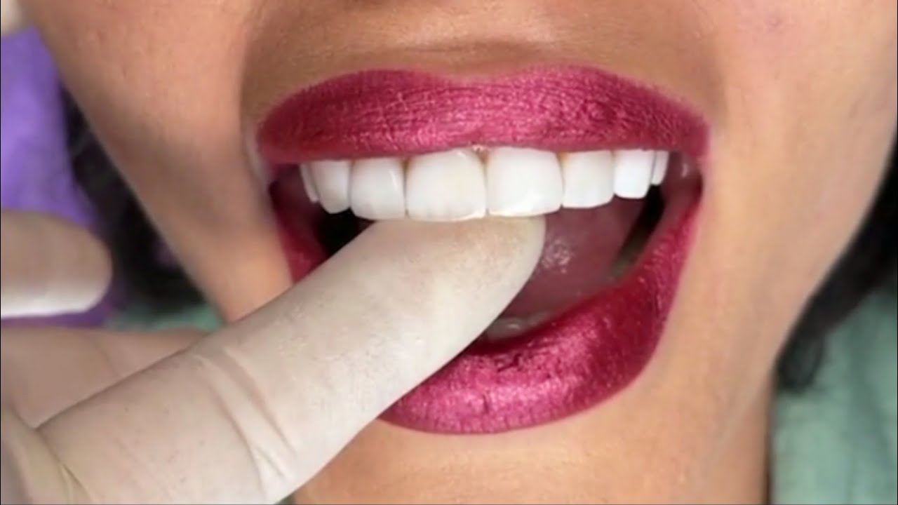 Face Teeth Lips Close Up 💋#SmileMakeover - YouTube