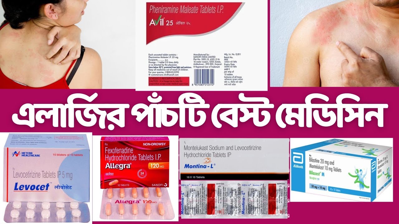 Top 5 allergy Medicine| Top 5 itching Tablets | Bengal Pharma - YouTube