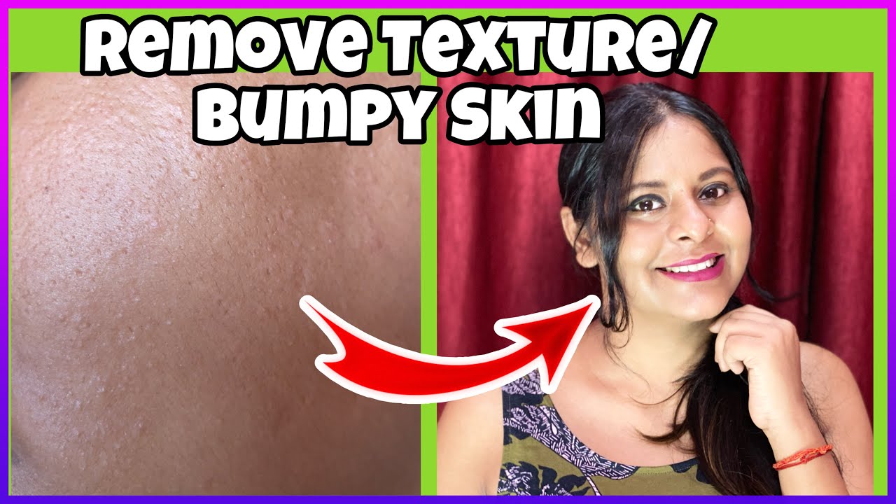 3 Steps To Get Rid Of Bumpy Skin How To Remove Textured Skin How To 3-steps-to-get-rid-of-bumpy-skin-how-to-remove-textured-skin-how-to
