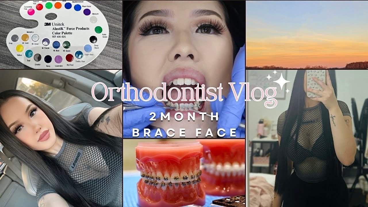 Braces Vlog Ep.4: 2 MONTH BRACES UPDATE + Orthodontist vlog - YouTube