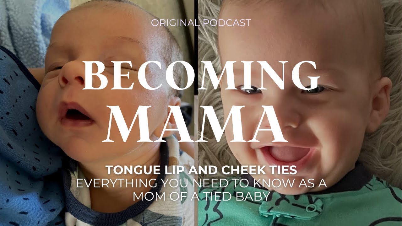 Tongue Ties, Lip Ties, and Cheek Ties - A Mom's Guide to Oral ...