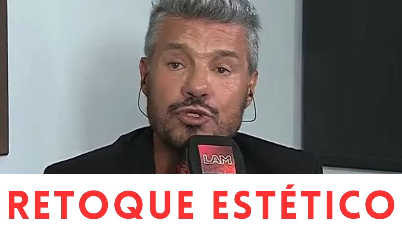 La cirugía estética de Marcelo Tinelli antes de la final del Bailando ...