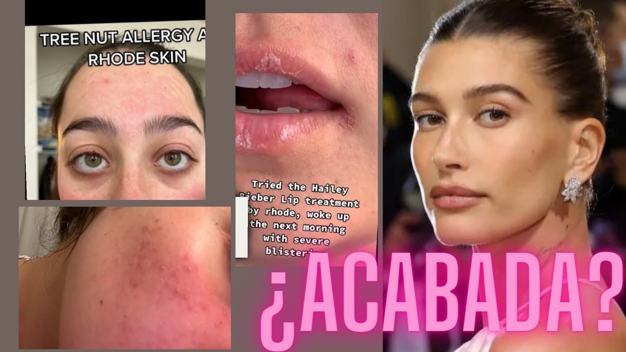 HAILEY BIEBER ACABADA, ACUSAN a su MARCA RHODE SKIN de DAÑAR la PIEL y ...