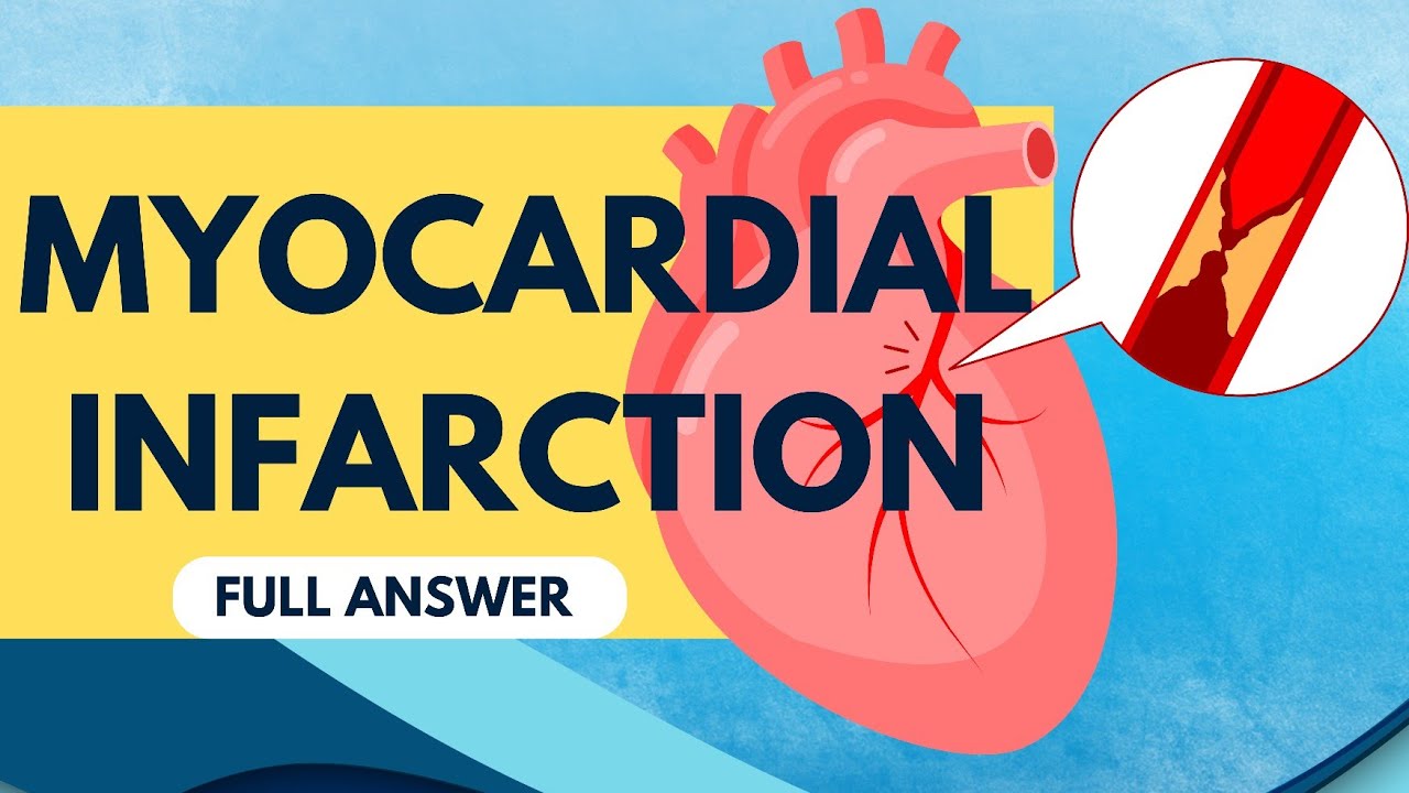 What is Myocardial Infarction | Full Answer | Causes, Pathophysiology ...