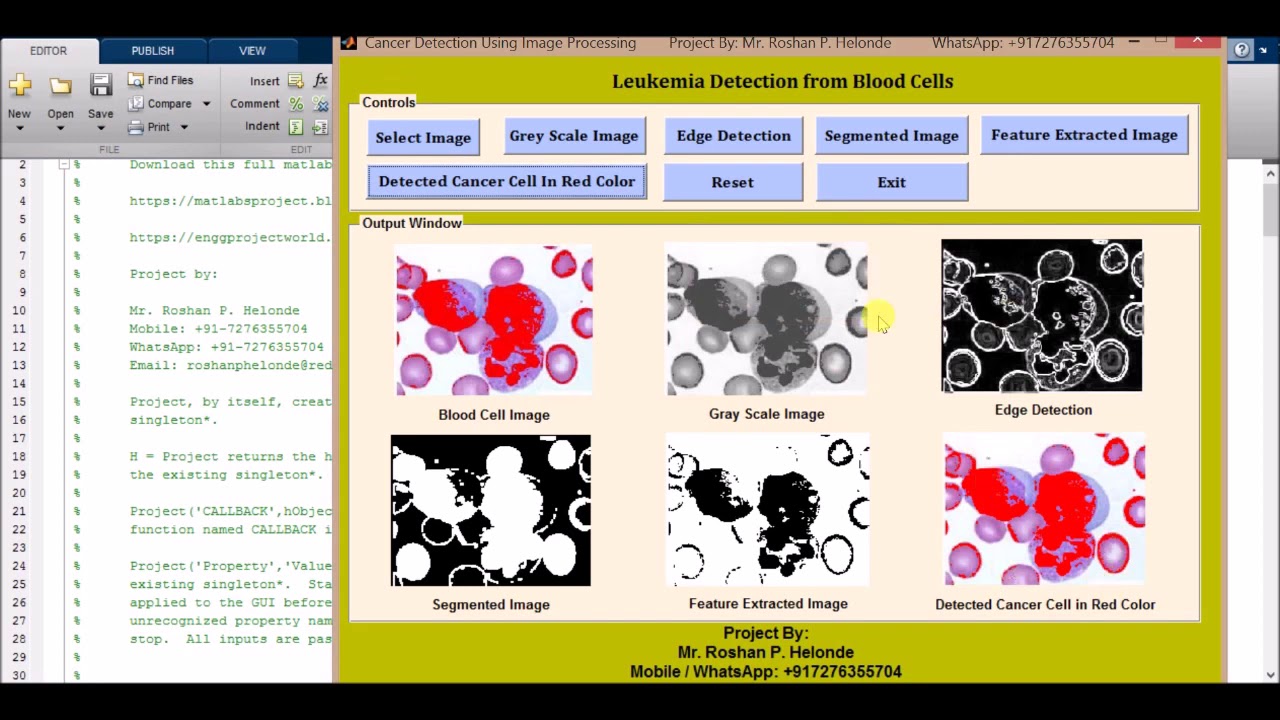 Matlab Project for Leukemia Detection from Blood Cells using neural ...
