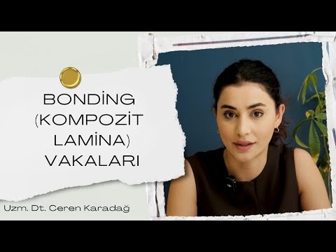 Kompozit Bonding ile Gülüş Estetiği | Öncesi Sonrası Karşılaştırma
