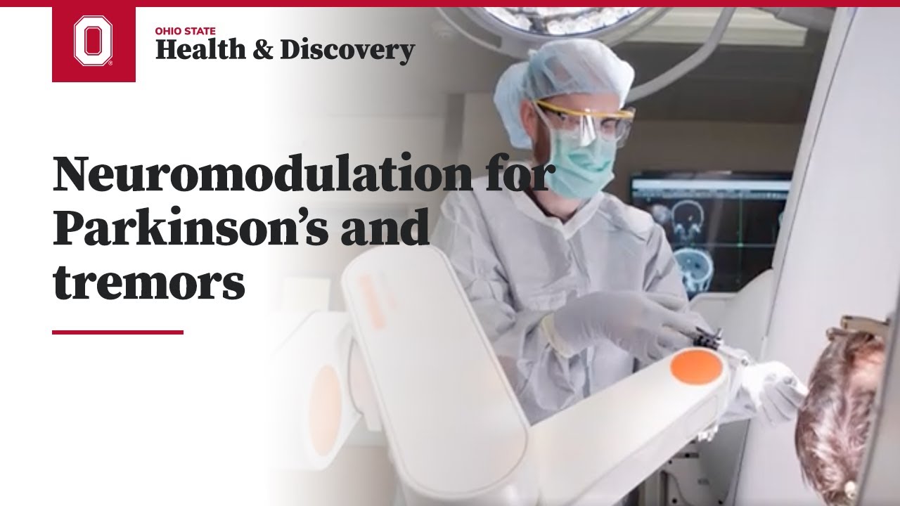 Neuromodulation for Parkinson's and tremors | Ohio State Medical Center ...