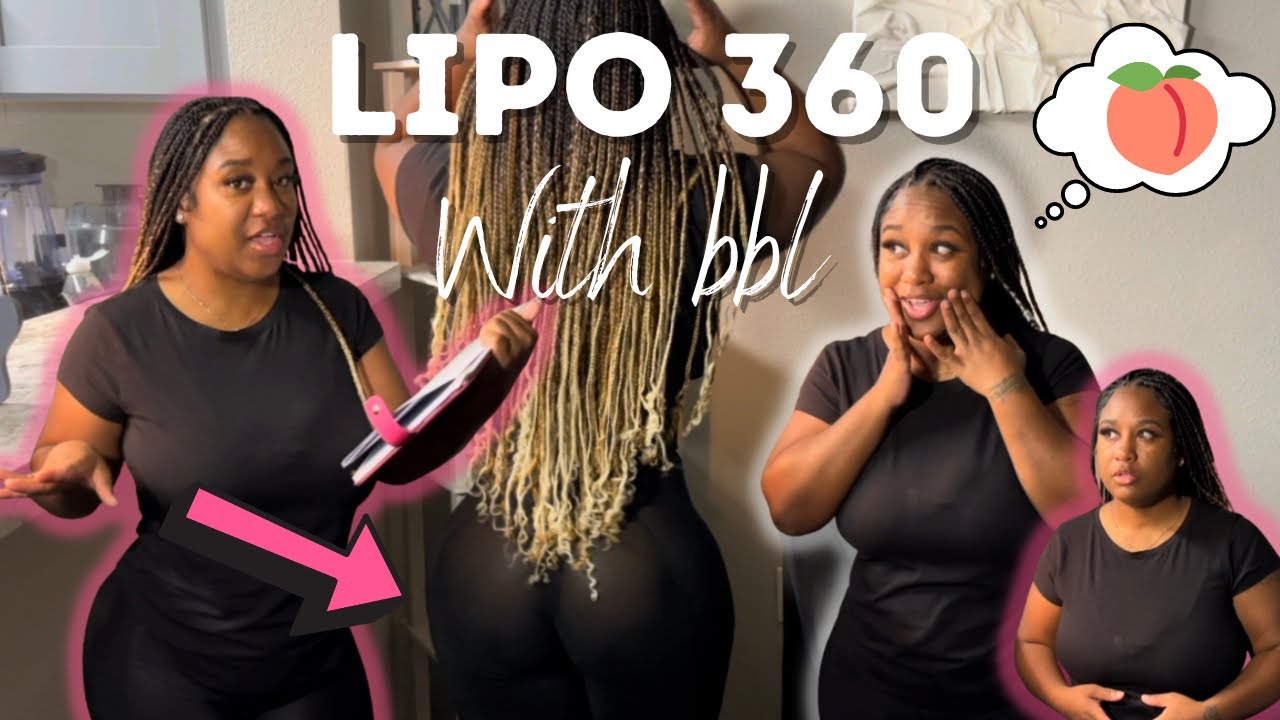 I got Lipo 360 with a bbl - YouTube