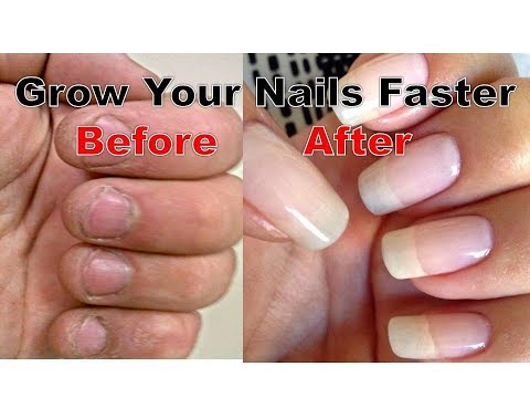 How to grow Nails Faster at Home | Easy Nails Growth idea | how to grow long nails