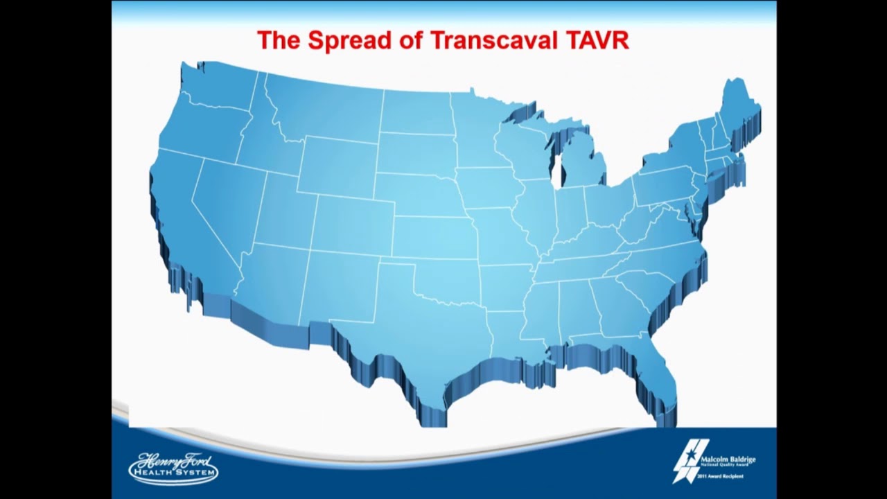 The Transcaval Approach to TAVR - Adam Greenbaum, MD - YouTube