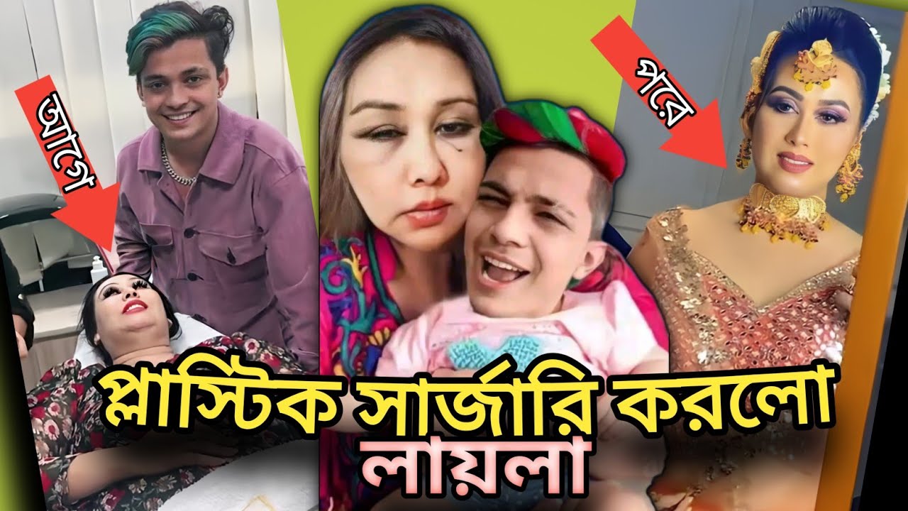 লায়লা প্লাস্টিক সার্জারি করে কতে সুন্দর হলো | Mamun Layla | Layla Vs ...