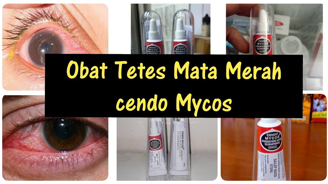 Obat Tetes Mata Cendo Mycos, untuk infeksi mata merah - YouTube