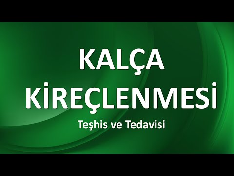 KALÇA KİREÇLENMESİ TEŞHİS VE TEDAVİSİ