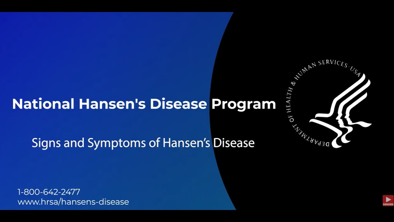 Signs and Symptoms of Hansen's Disease - YouTube