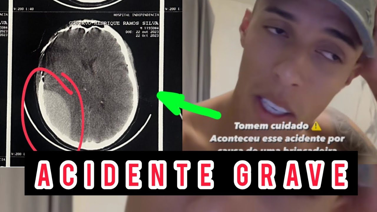 BUZERA EXPLICA O QUE ACONTECEU COM O KABRINHA NA HORA DO ACIDENTE - YouTube