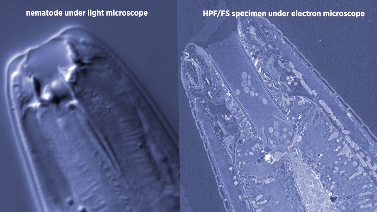 Using high pressure freezing to image microscopic worms - YouTube