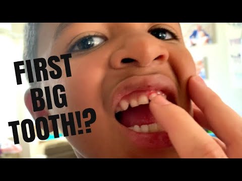 FIRST BIG TOOTH GETS A HUGE YANK! - YouTube