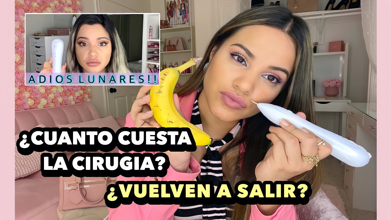 ME REMOVI LUNARES DE LA CARA RECUPERACION Y TODO SOBRE LA CIRUGIA ...