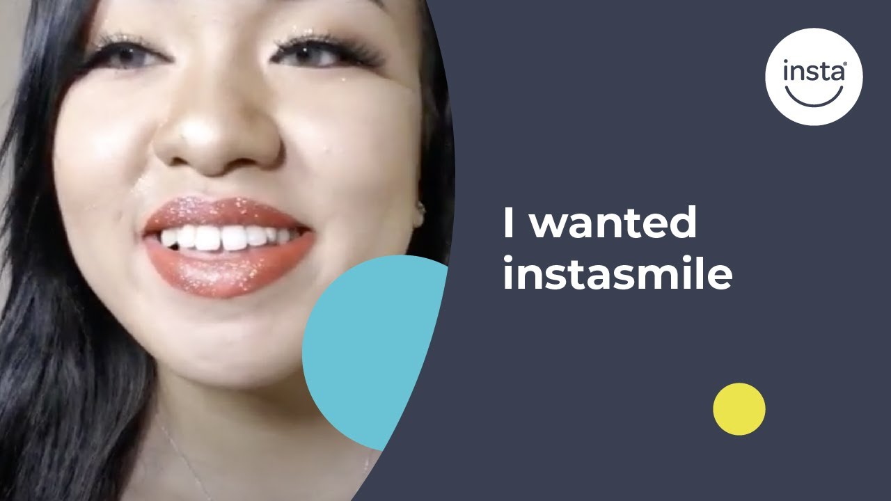 Clip On Veneers: Avoiding Braces & Surgeries | Instasmile Review - YouTube