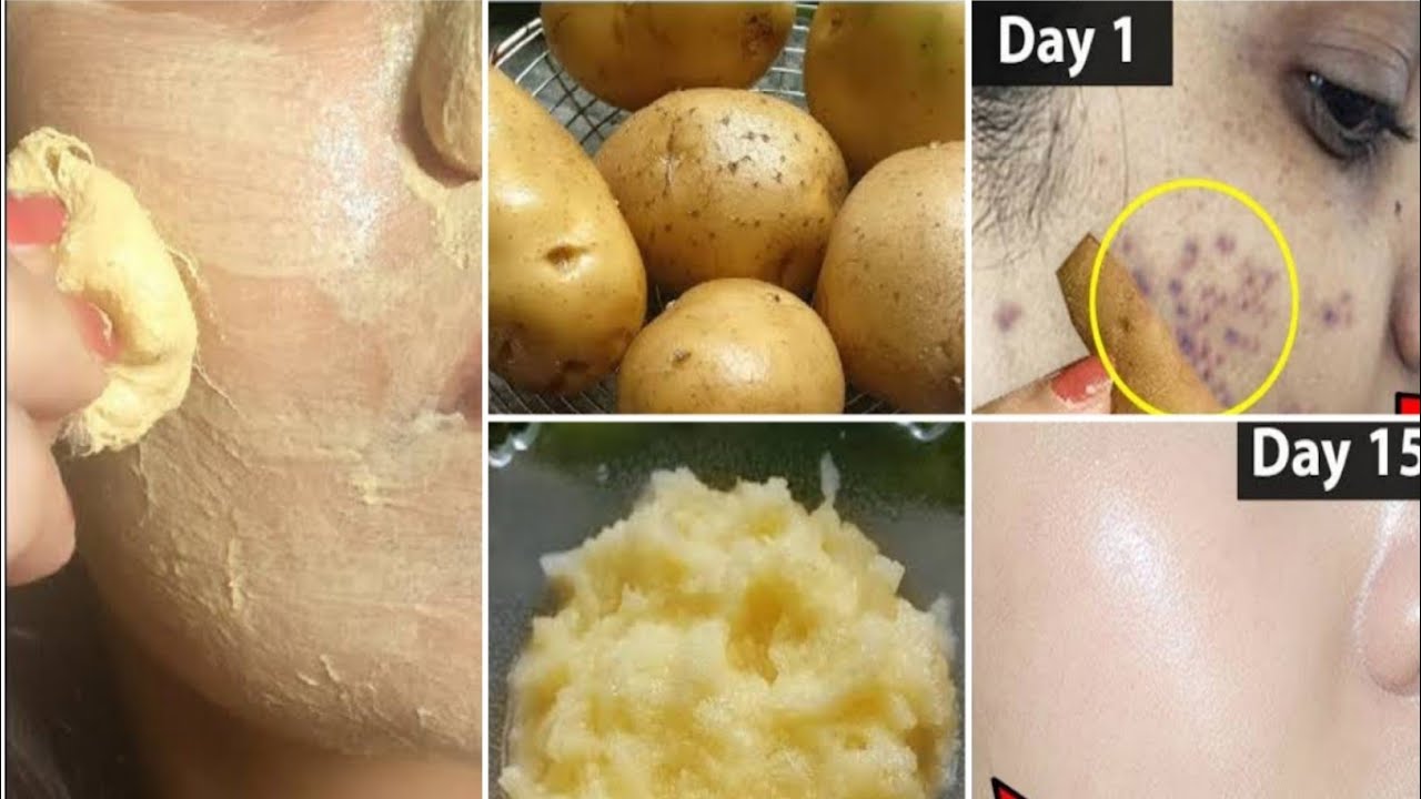 Potato face pack for skin whitening, spotless fair and glowy face ...