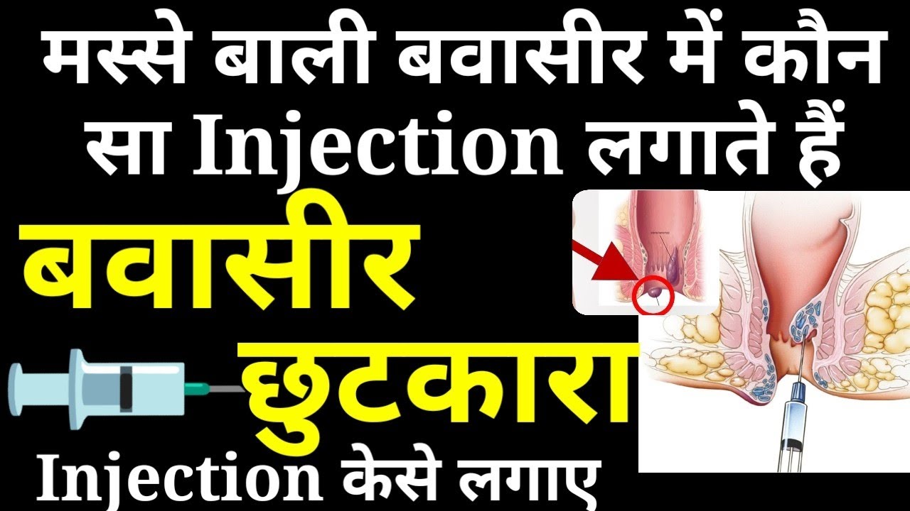 मस्से वाली बवासीर का injection / Piles treatment / Piles ka ilaaj ...