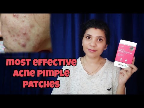 The derma co micro tip acne patch | Acne pimple patches for active acne ...