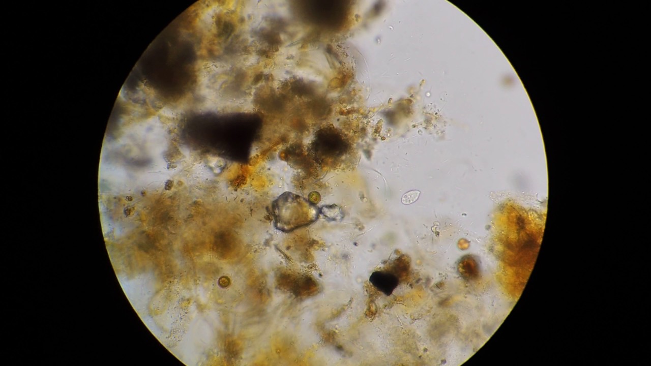 microorganismos desde el microscopio - YouTube