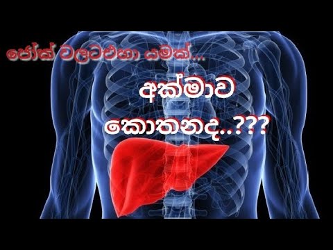 අක්මාව තියෙන තැන.... Akmawa thiyena thana... Lovely 💘 City... - YouTube