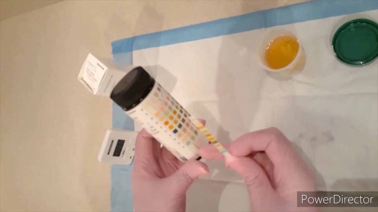 Urinalysis Random Sample - YouTube
