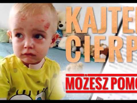 Kajtek potrzebuje 6 mln, aby przestał cierpieć! - YouTube