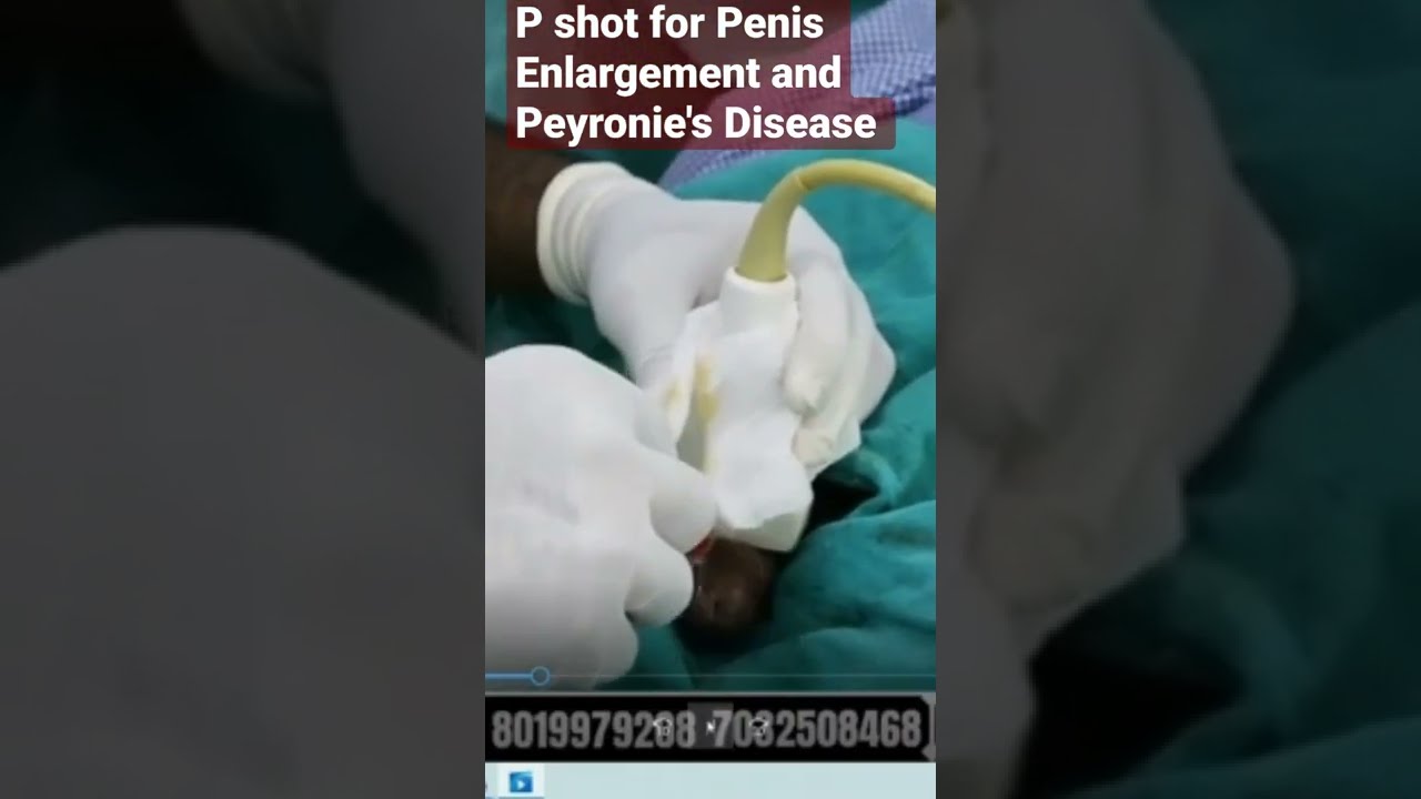 #pshot for #penisenlargement & #peyronies #shorts #reels #penis #health ...