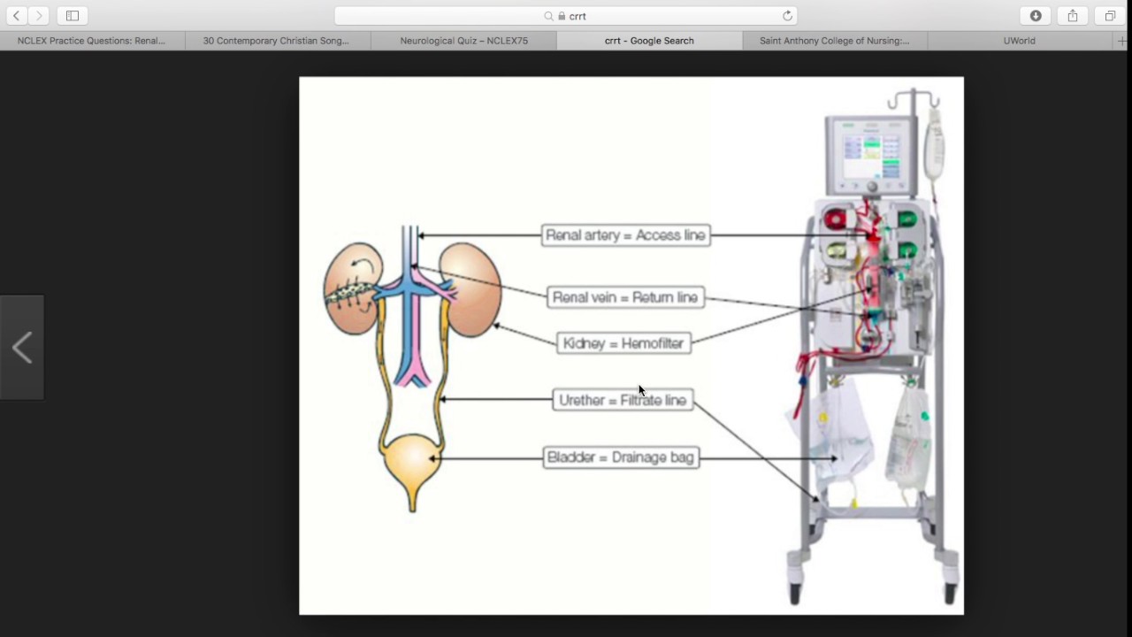 Continuous Renal Replacement Therapies (CRRT) - YouTube