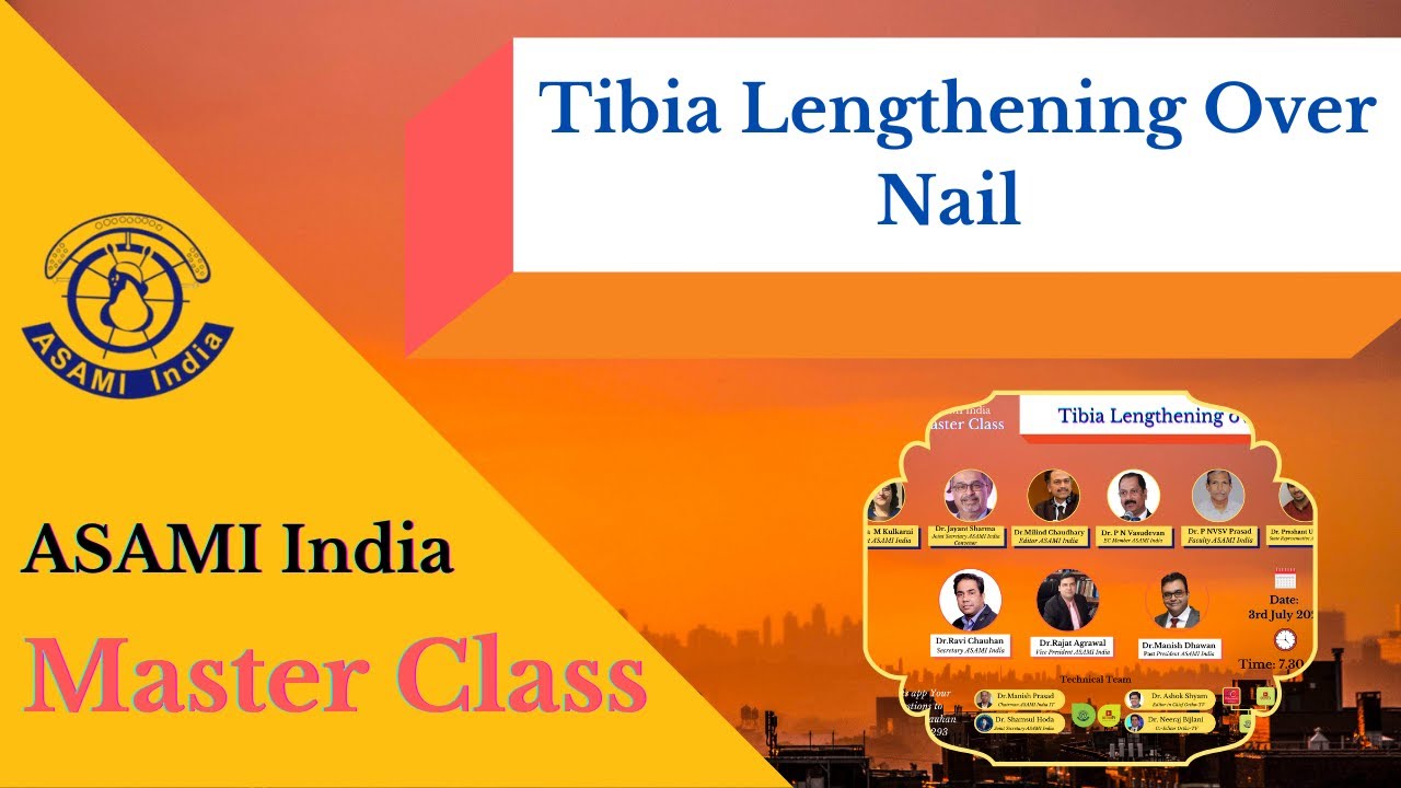 Tibia Lengthening Over Nail - YouTube