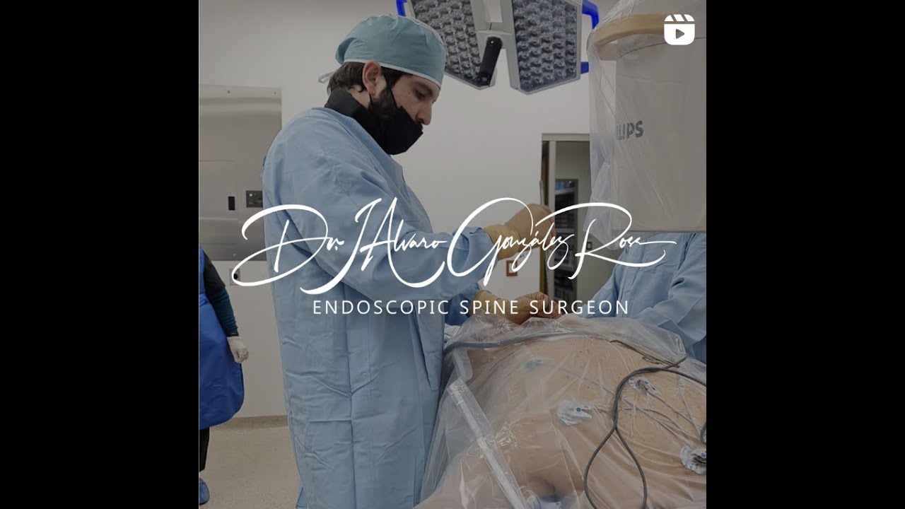 Motion sparing endoscopic decompression of C2C3 in a previously fused patient from C3-T2 T10 ...