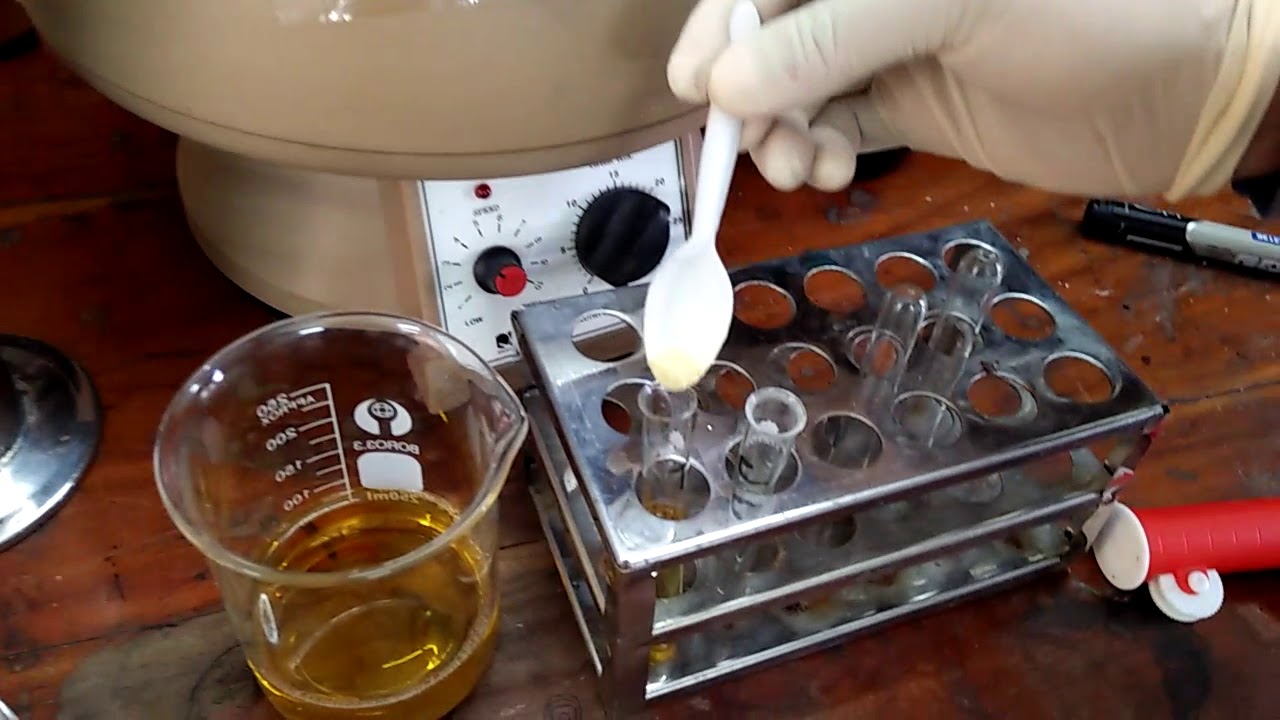 Urine analysis: Hay's surface tension test - YouTube