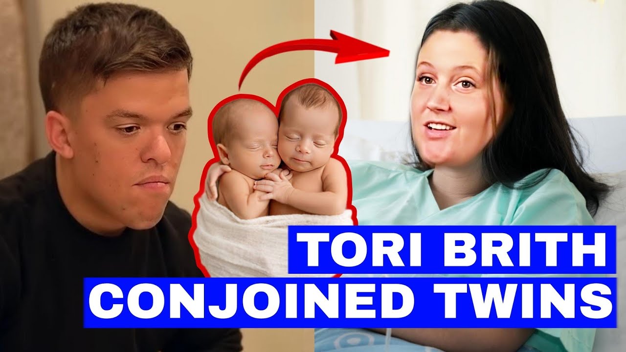 TODAY TORI ROLOFF BRITH CONJOINED TWINS BABY 🥰 | ZACH,. AMY ROLOFF ...