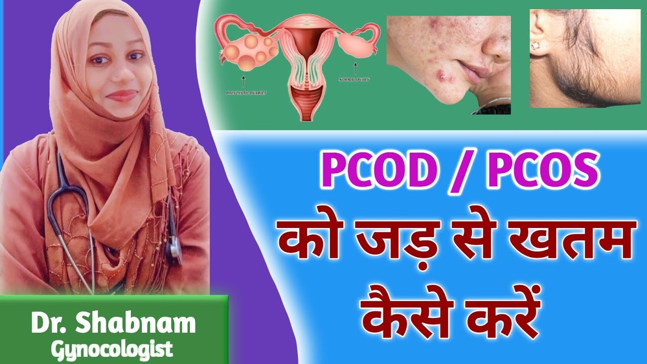Pcod kya hota hai /PCOD/PCOS ka jad se ilaj #pcod #pcoddiet #pcos # ...