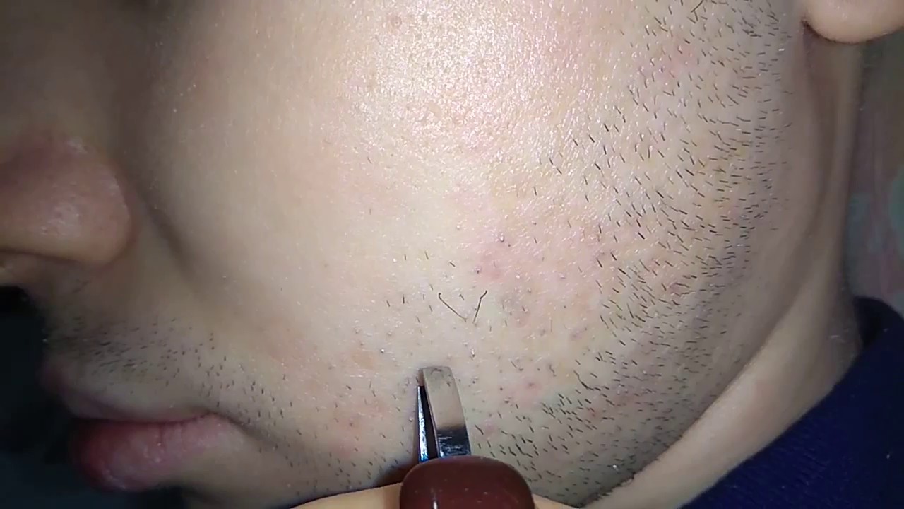 Pull out the beard Plucking facial hair - YouTube