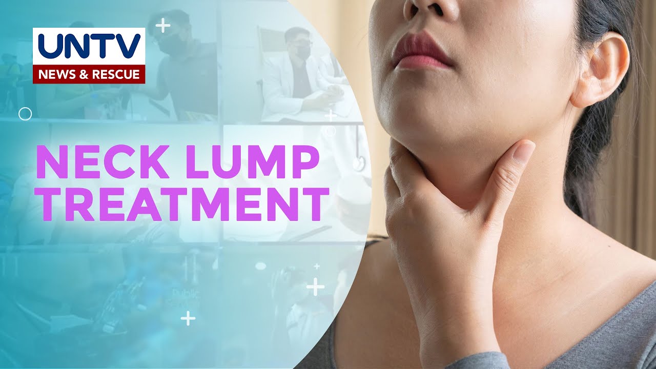 Neck lump o bukol sa leeg, may lunas o nagagamot ba? - YouTube