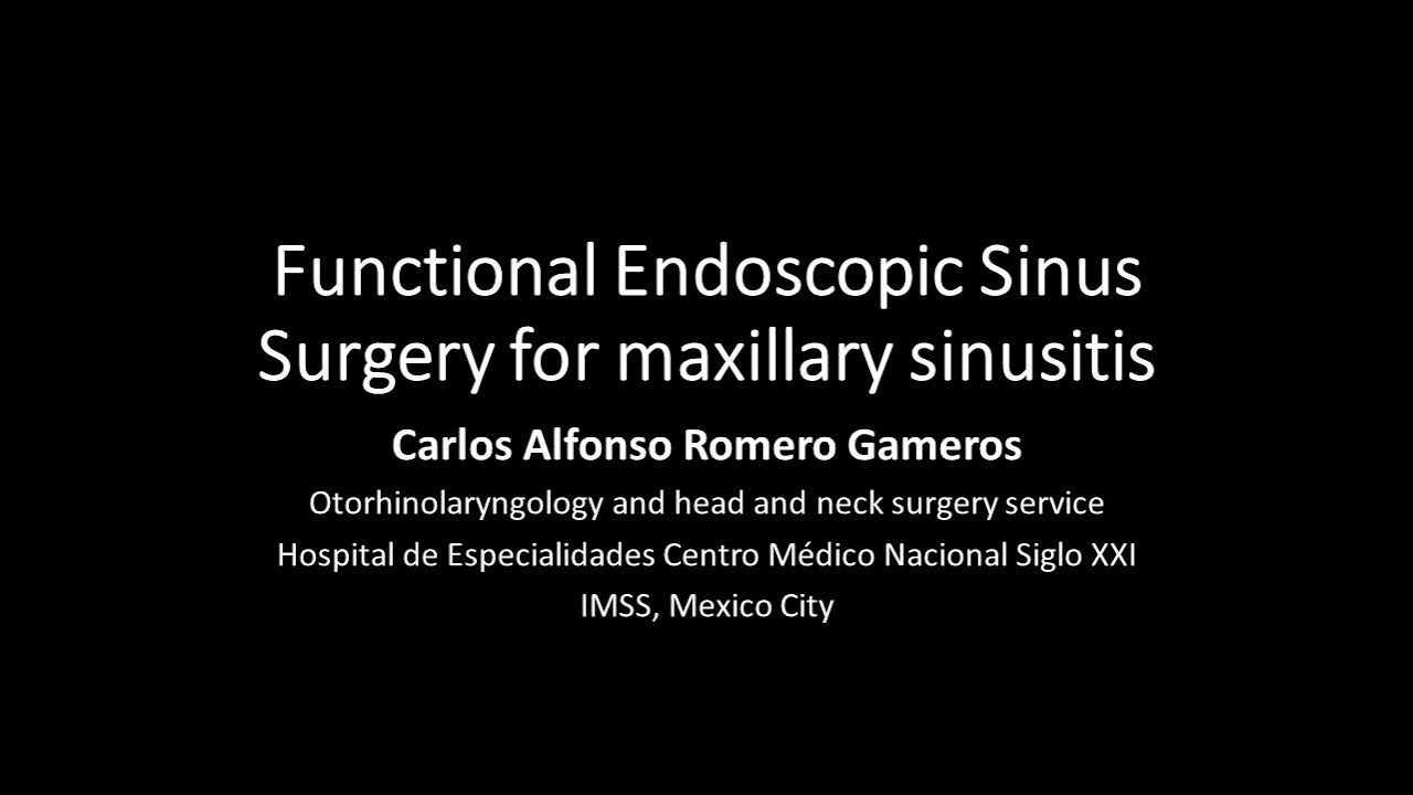 Functional Endoscopic Sinus Surgery for maxillary sinusitis - YouTube