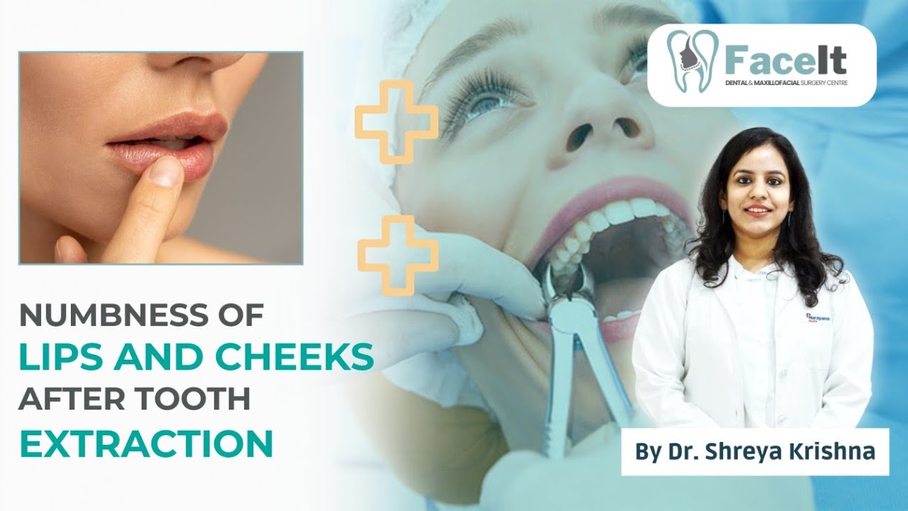 Numbness of lips and cheeks after tooth extraction or wisdom tooth ...