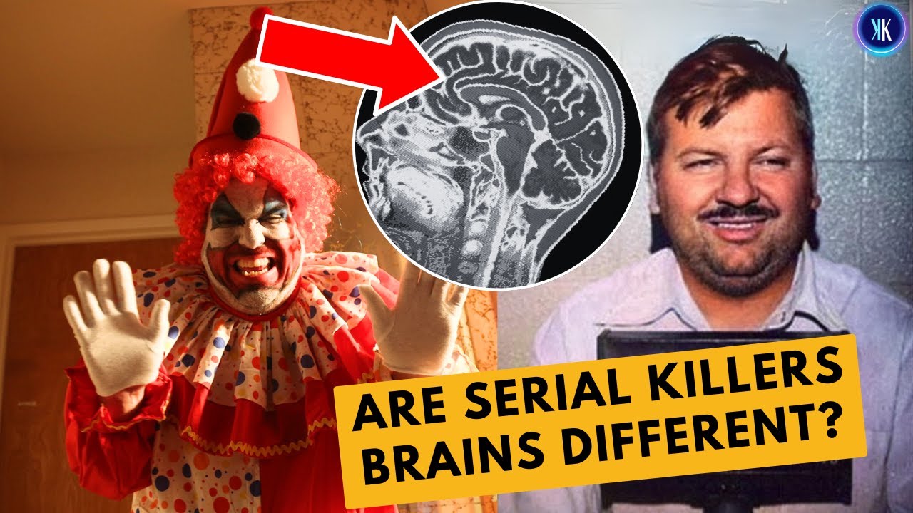 Serial Killers Brains Reveal Extraordinary Discovery - YouTube