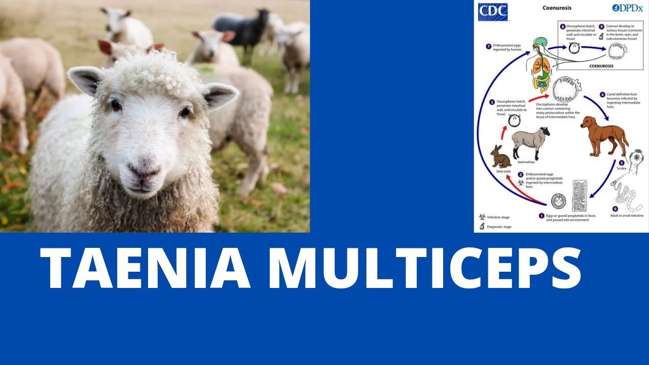 part 2 (TAENIA MULTICEPS) - YouTube