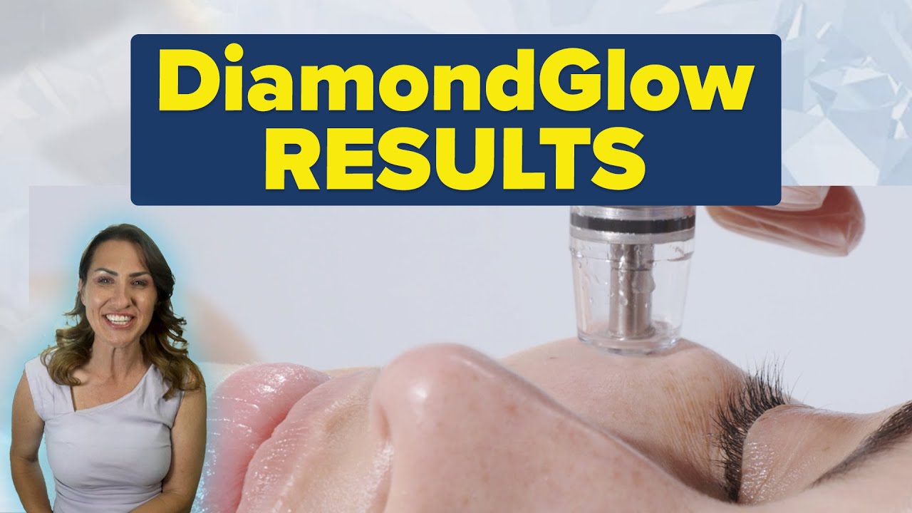 Diamond Glow Microdermabrasion System: The Ultimate Skincare Solution ...